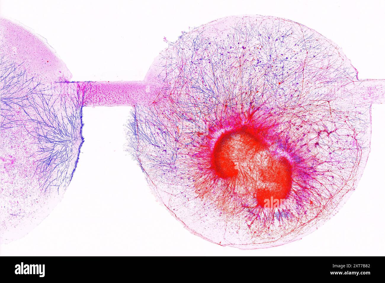 Confocal light micrograph of a synaptic conjugation between three ...
