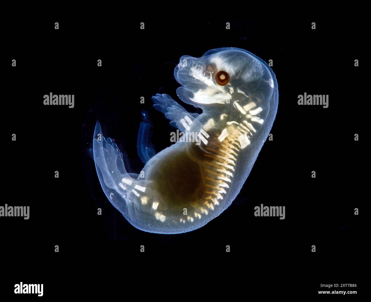 Light micrograph of a mouse (Mus sp.) embryo that has been treated to ...