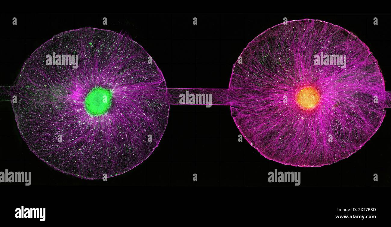 Confocal light micrograph of a synaptic conjugation between three ...