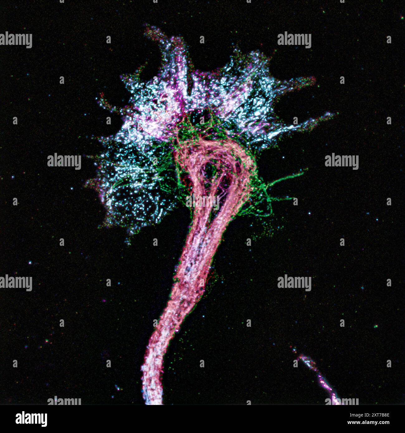 Light micrograph of a nerve cell (neuron) that has been prepared with ...