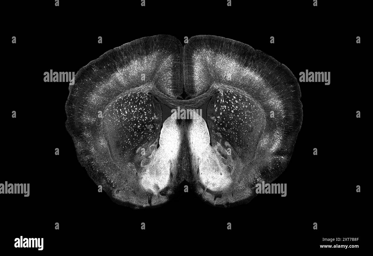 Confocal light micrograph of a section of a whole mouse (Mus sp.) brain ...