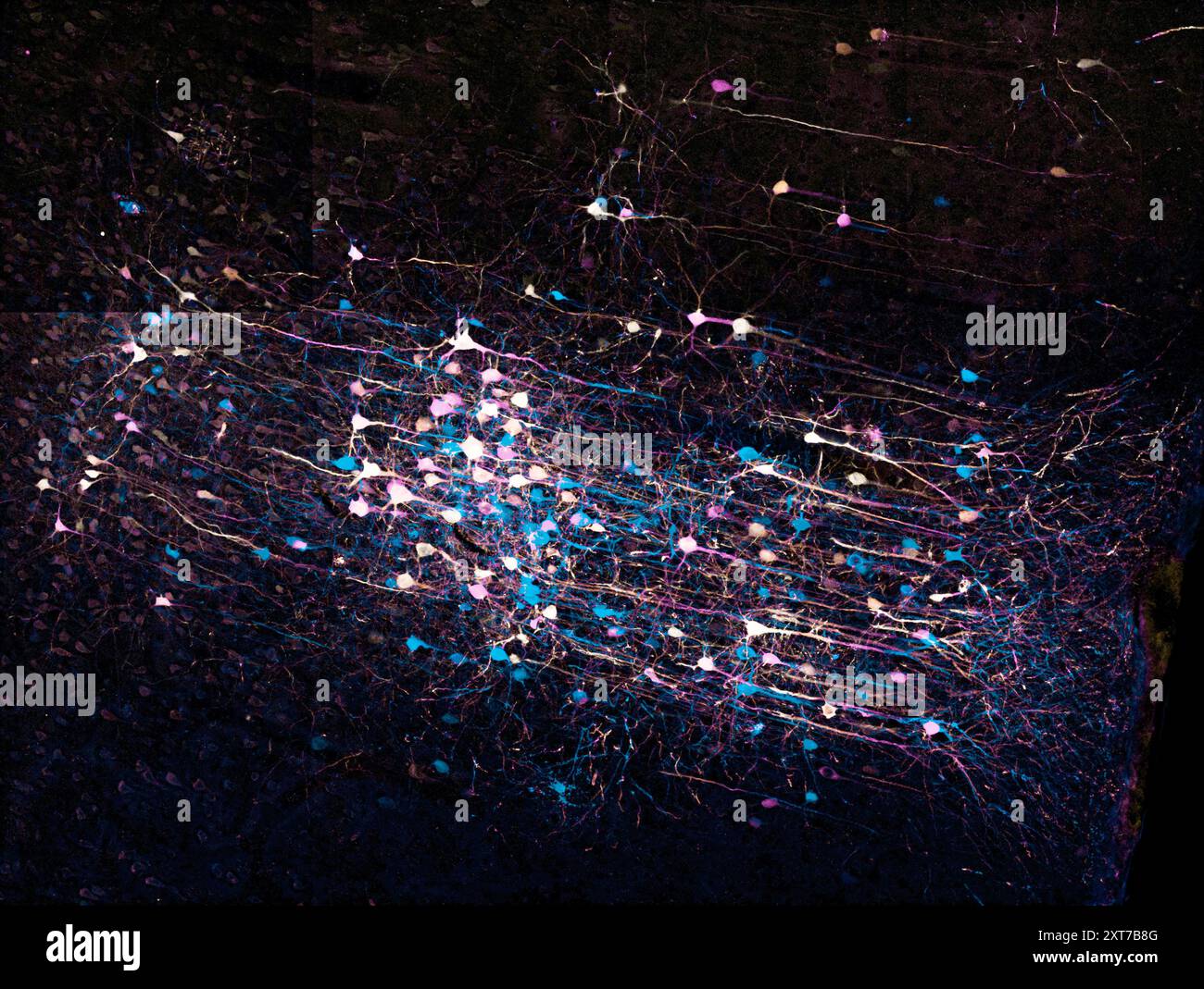 Confocal light micrograph of neurons (nerve cells) in a mouse (Mus sp ...