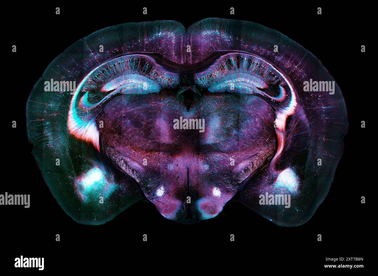 Confocal light micrograph of a section of a whole mouse (Mus sp.) brain ...