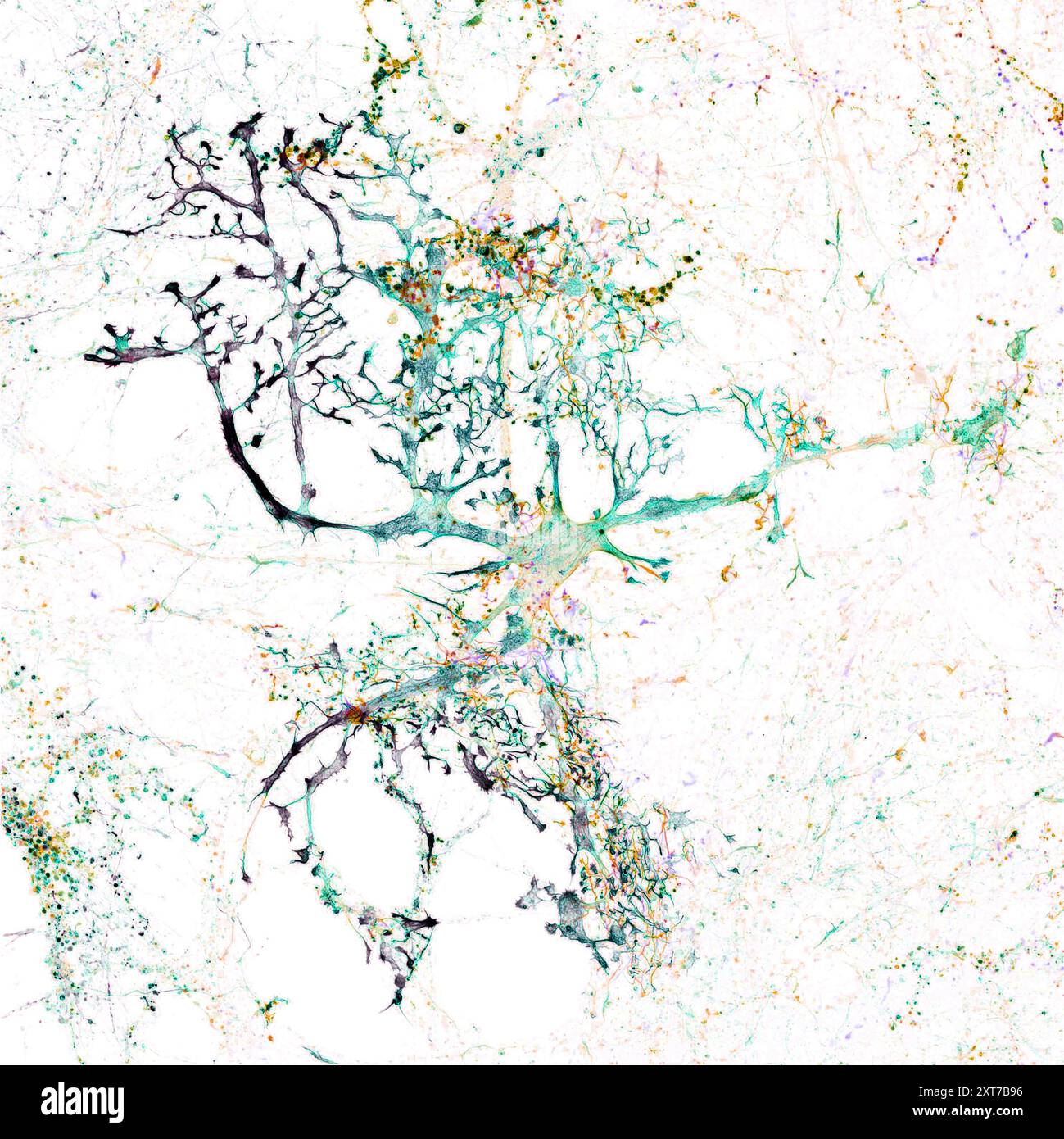 Confocal light micrograph of astrocyte cells. Astrocytes are a type of ...