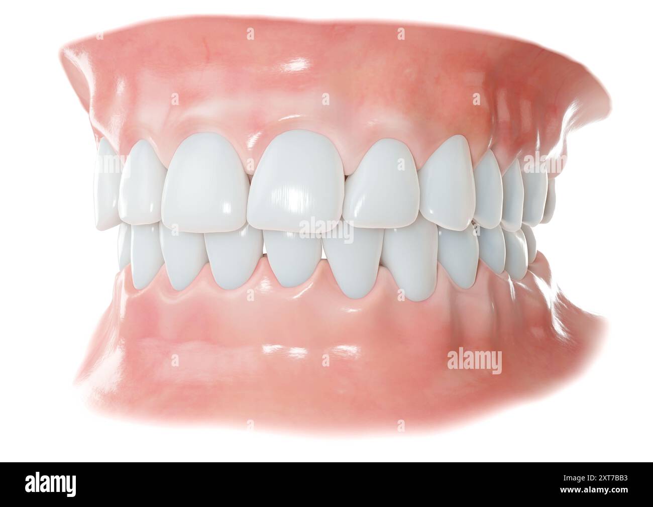 Illustration of a normal bite (normal occlusion). With this tooth ...