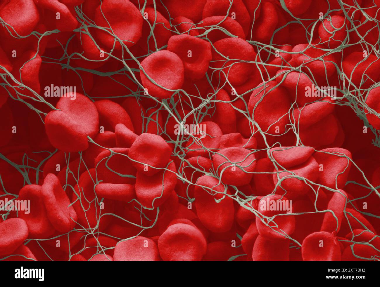Red blood cells (erythrocytes) in a fibrin mesh, coloured scanning ...
