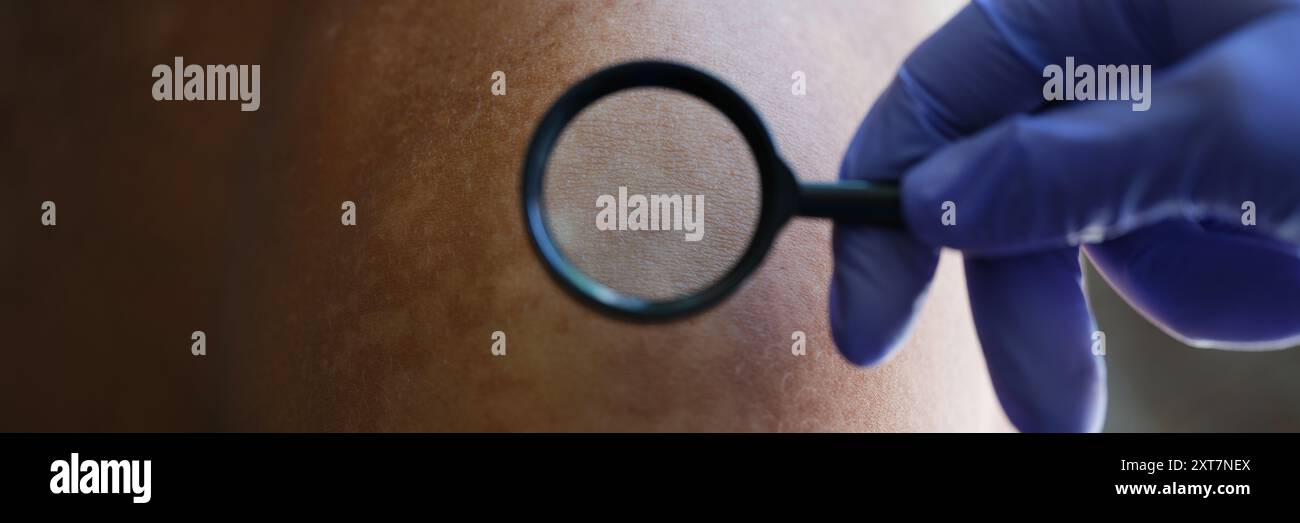 Doctor hand holding magnifier glass and examining patient shoulder ...
