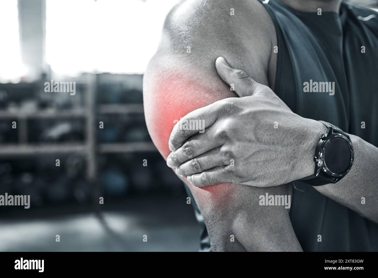 Athlete bruise swollen hi-res stock photography and images - Alamy