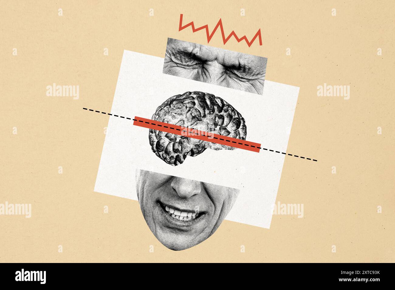 Composite photo collage of unhappy frown man half face brain organ ...