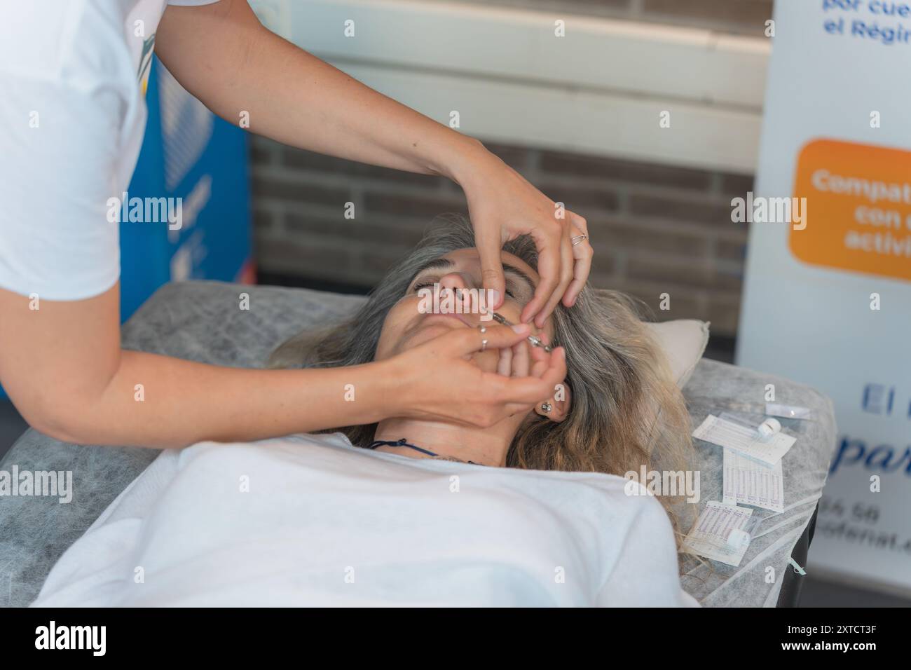 Girl doing acupuncture on the face of a mature woman Stock Photo - Alamy