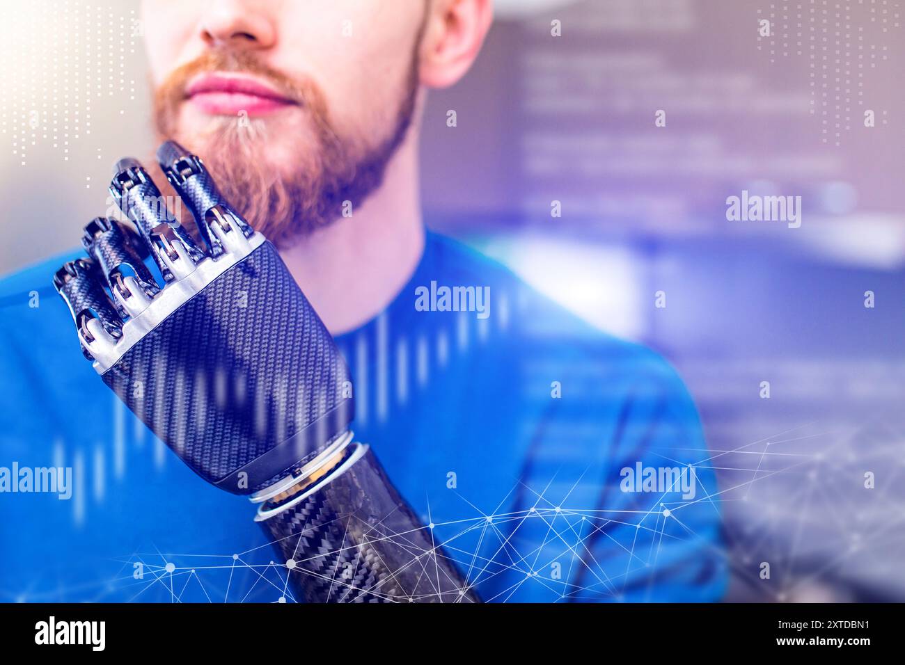 A man with a prosthetic hand is wearing a blue shirt Stock Photo - Alamy