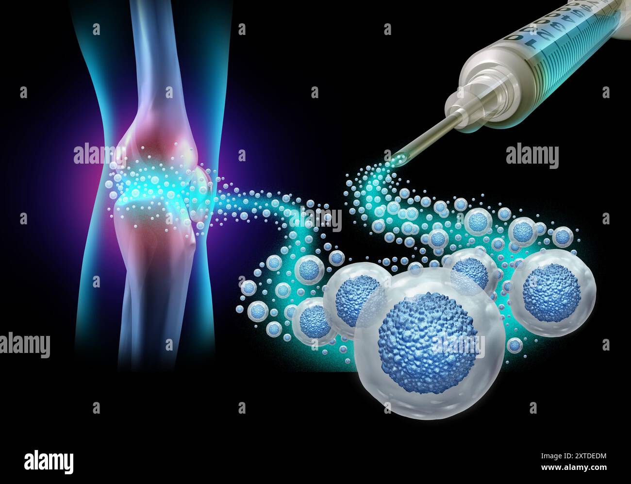 Regenerative Medicine and Mesenchymal Stem Cells injected for Knee ...