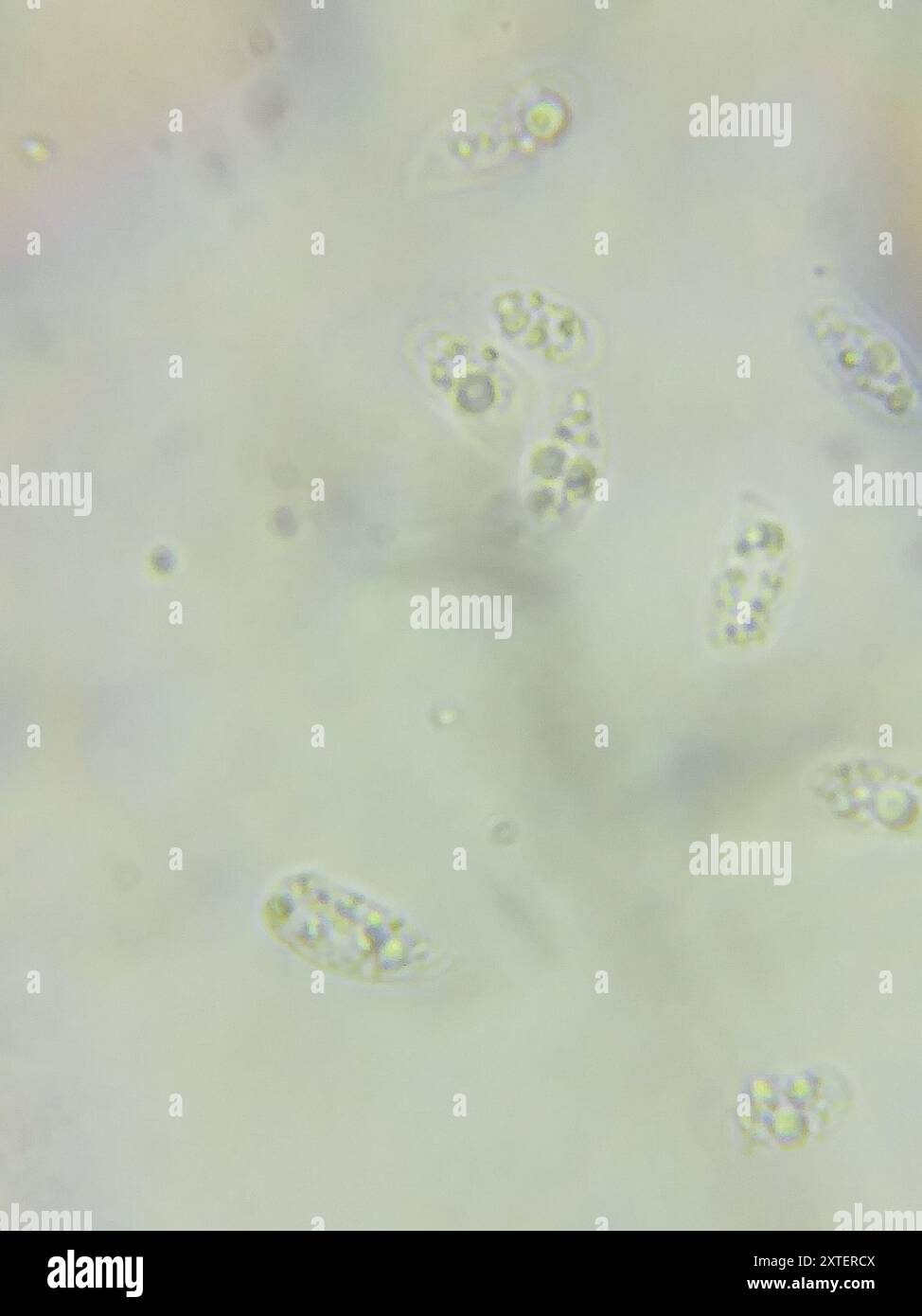 Dripping bonnet hi-res stock photography and images - Alamy