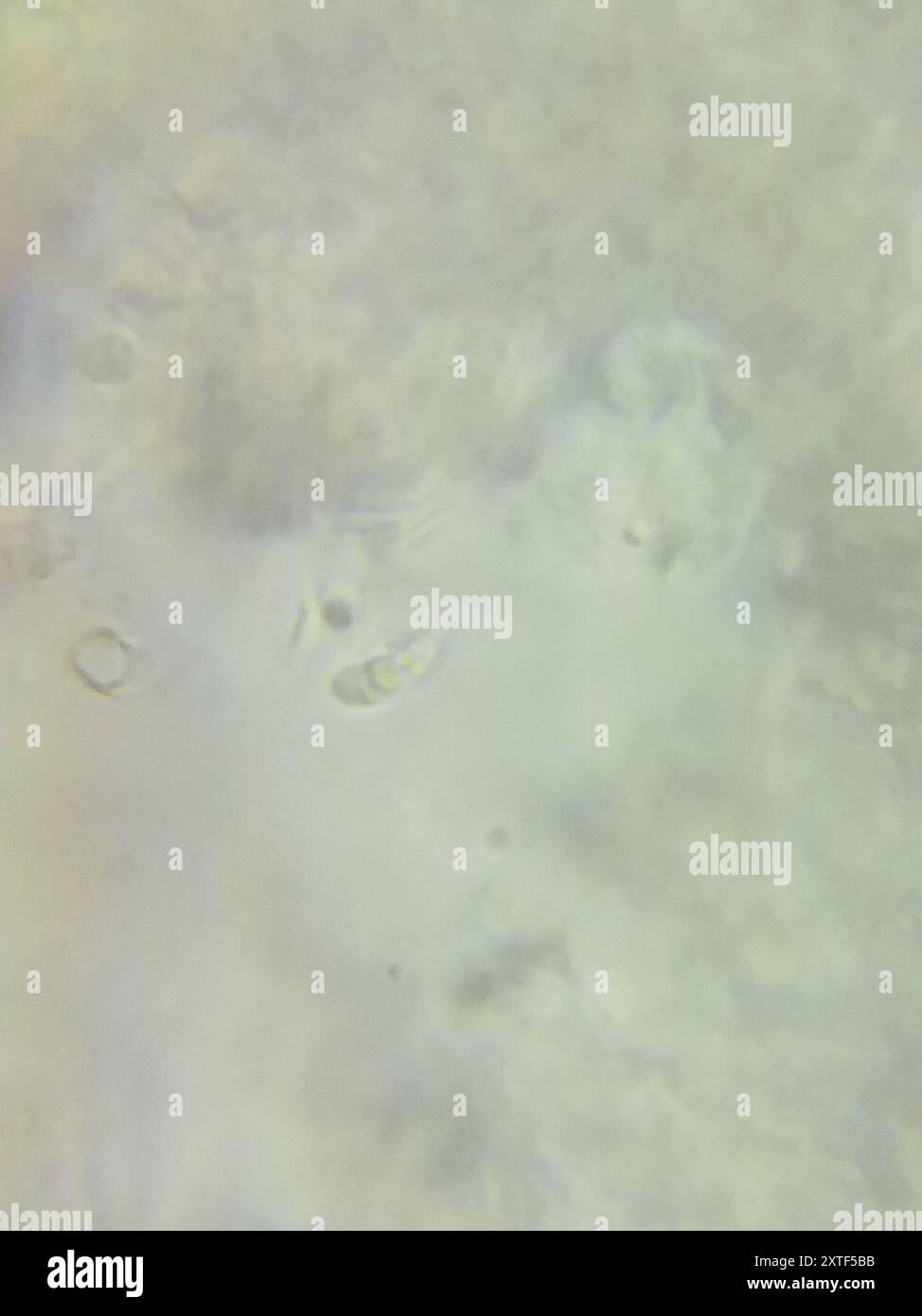 pinwheel family (Marasmiaceae) Fungi Stock Photo - Alamy