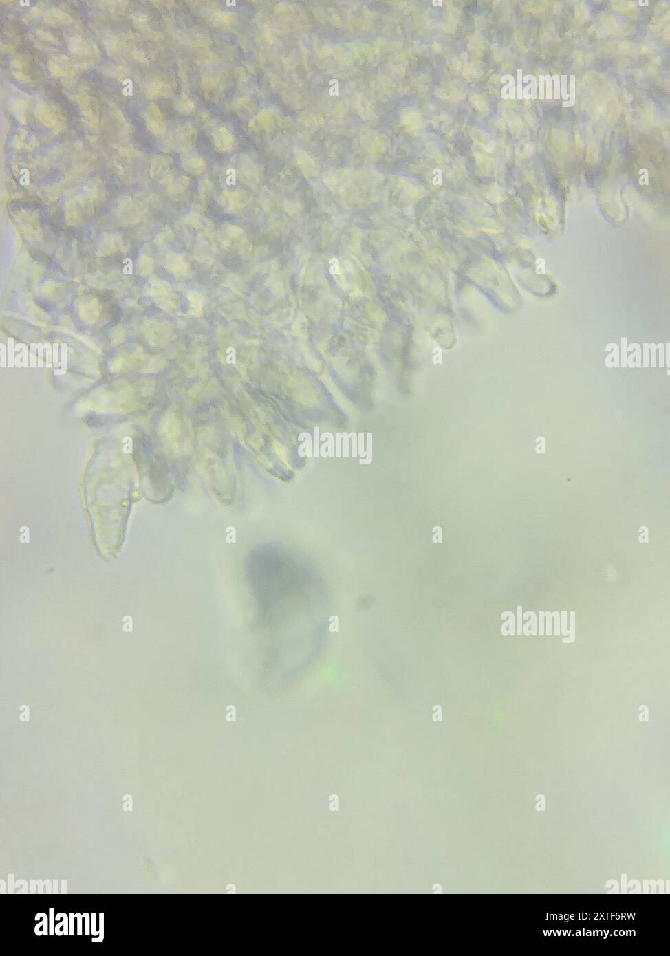 Dripping bonnet hi-res stock photography and images - Alamy