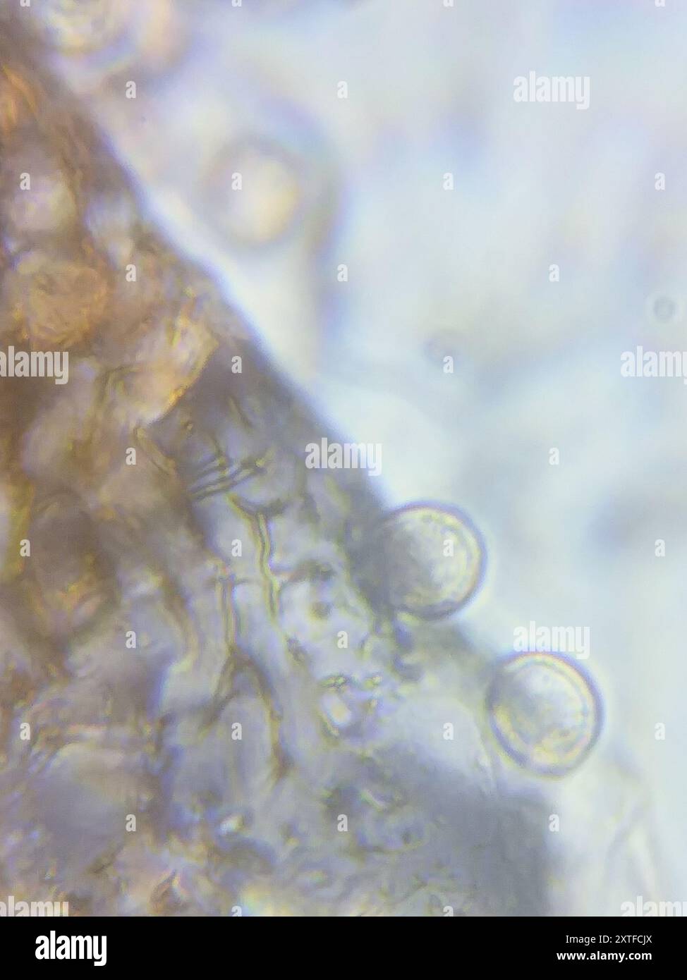 (Arcyria major) Protozoa Stock Photo - Alamy