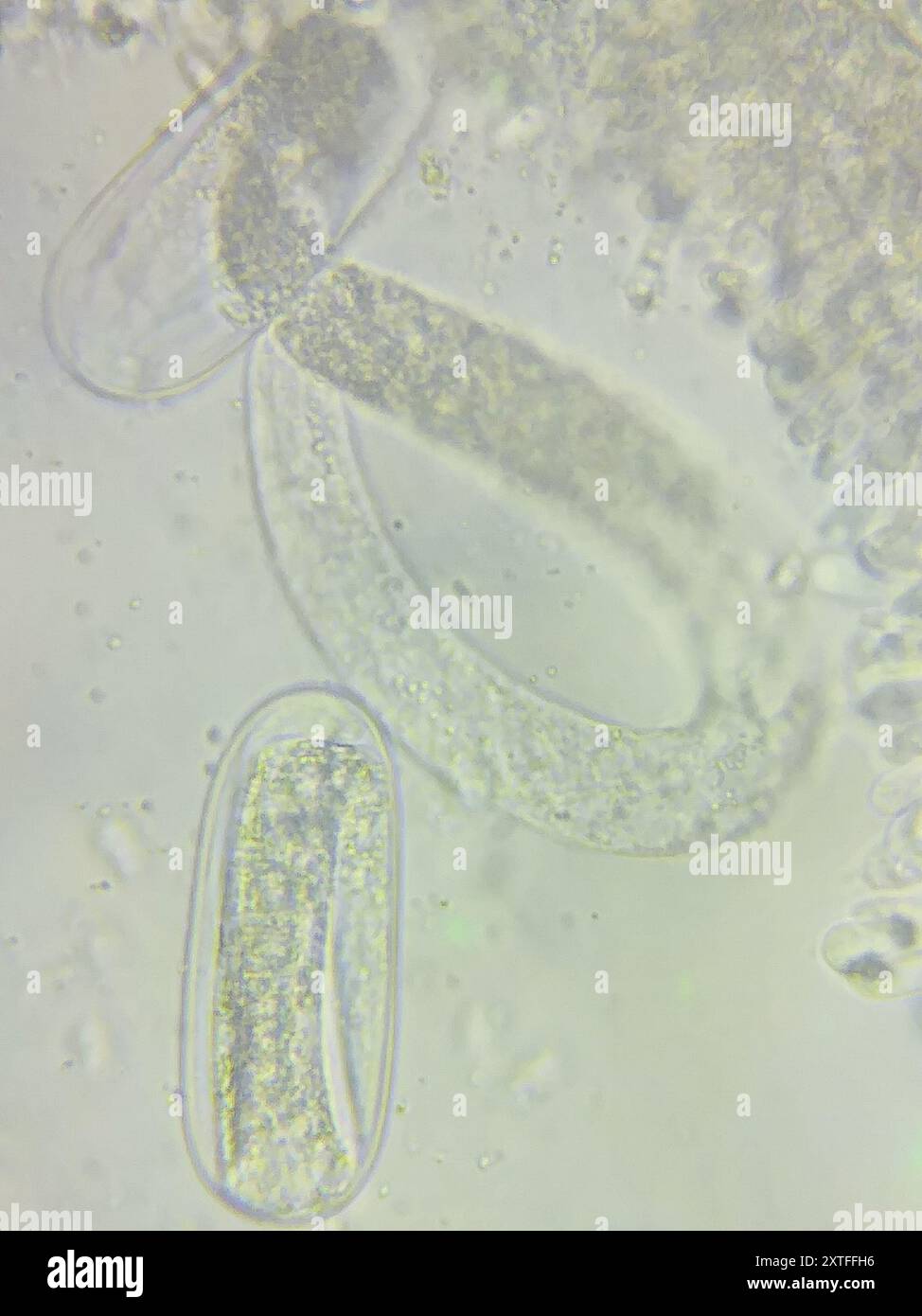 Dripping bonnet hi-res stock photography and images - Alamy