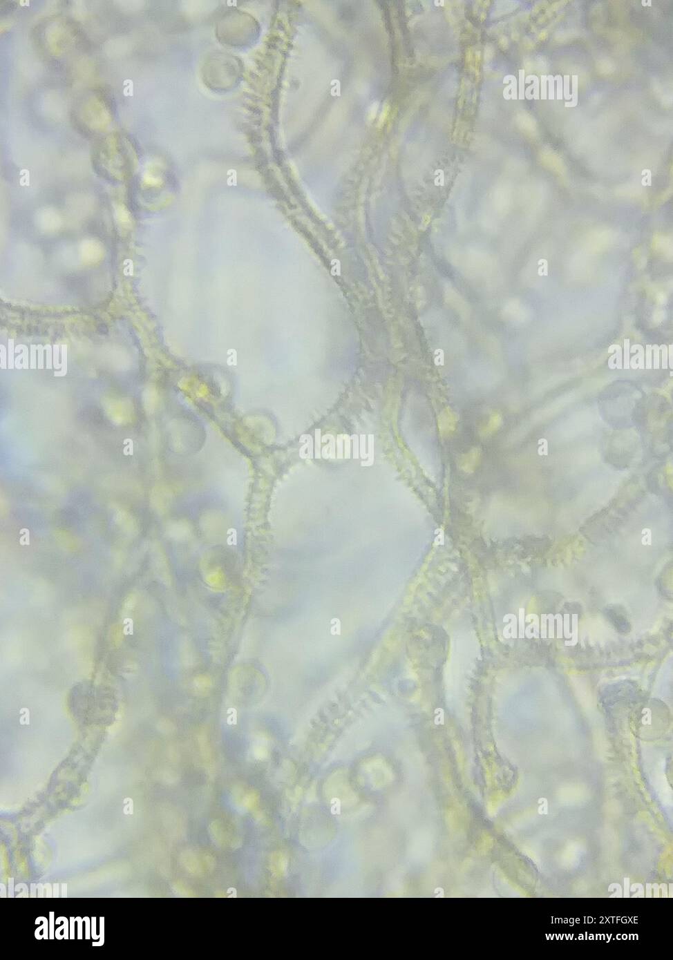 (Arcyria major) Protozoa Stock Photo - Alamy