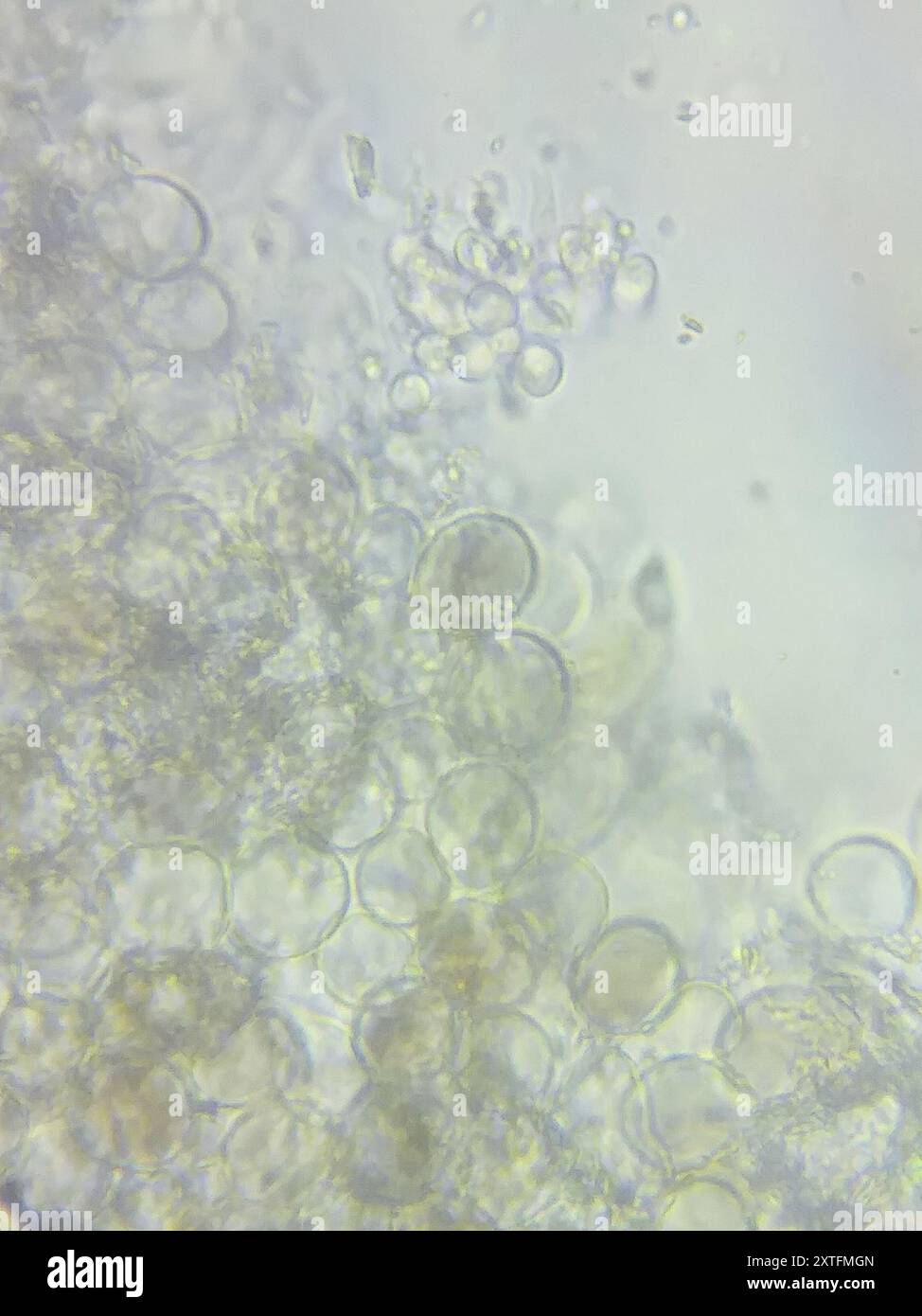 Dripping bonnet hi-res stock photography and images - Alamy