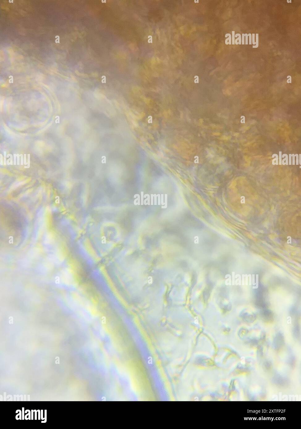 (Arcyria major) Protozoa Stock Photo - Alamy