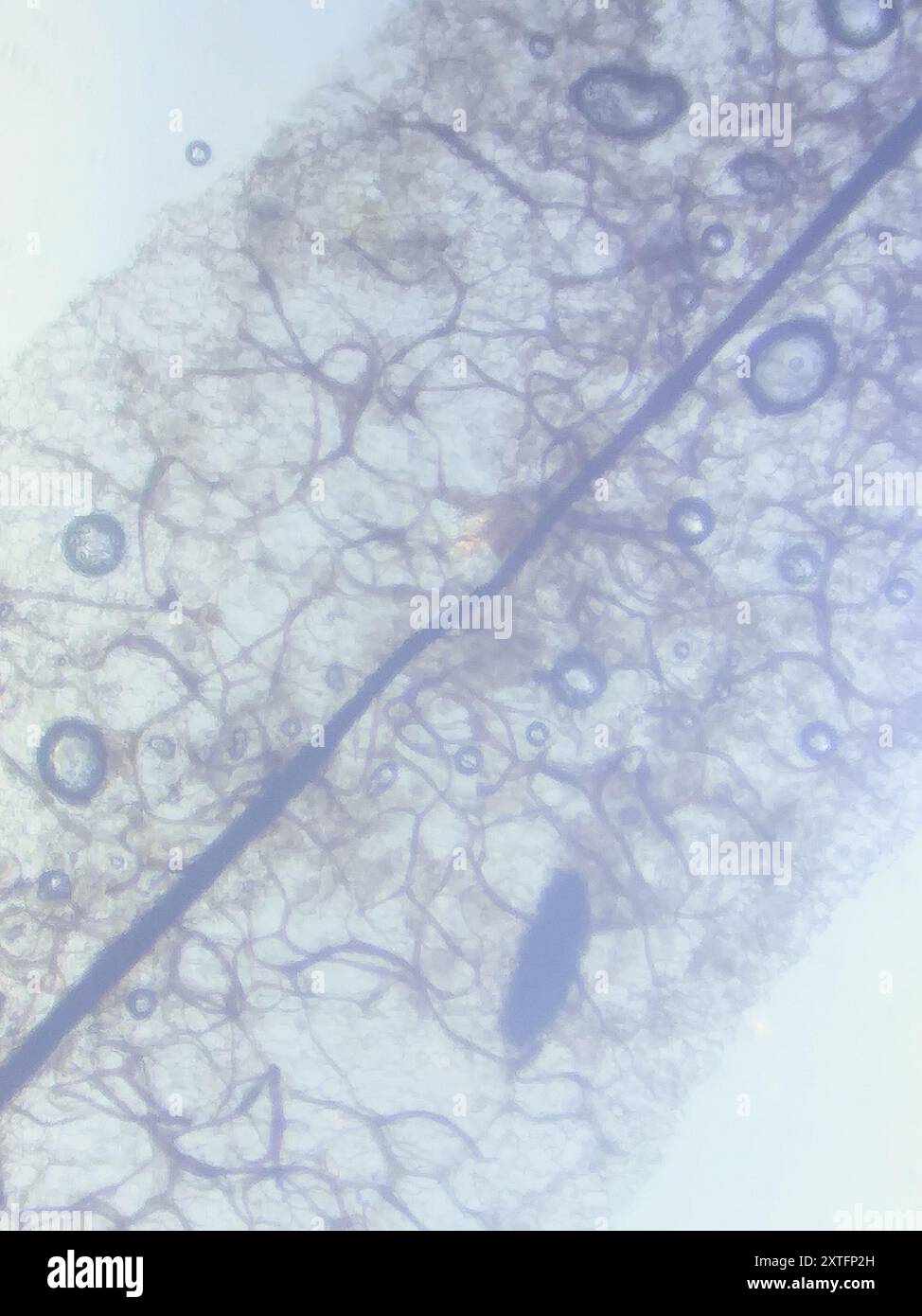 (Stemonitis axifera) Protozoa Stock Photo - Alamy