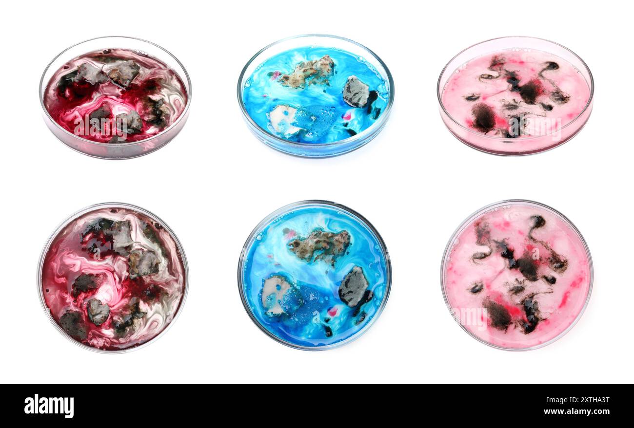 Set of Petri dishes with different bacteria colonies on white ...