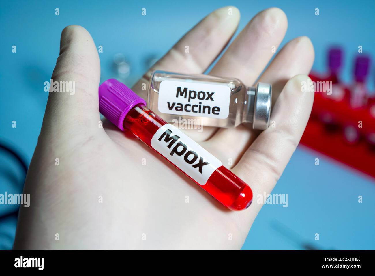 Blood collection tubes Mpox and vaccine,WHO to rename monkeypox as ...