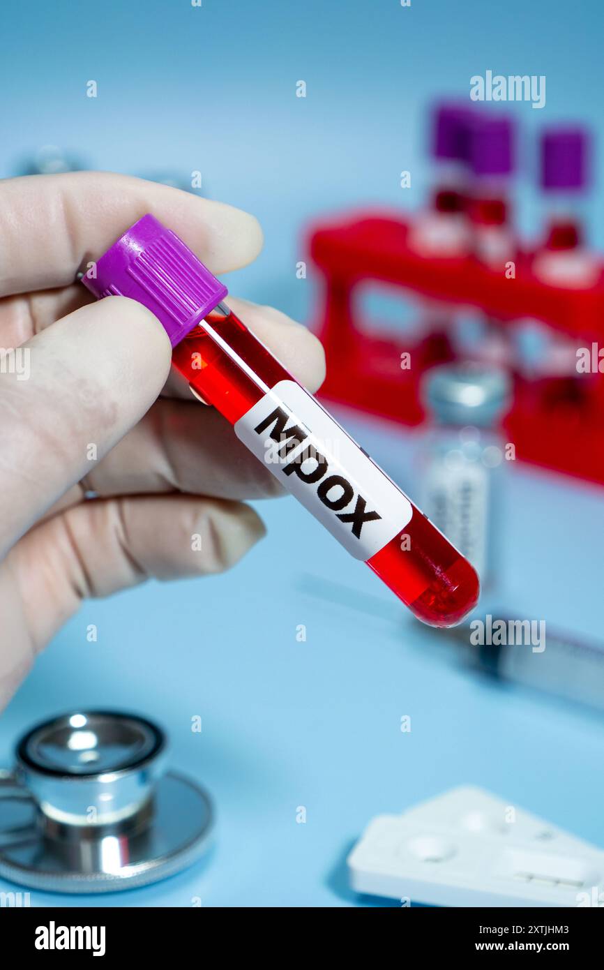 Mpox hi-res stock photography and images - Alamy