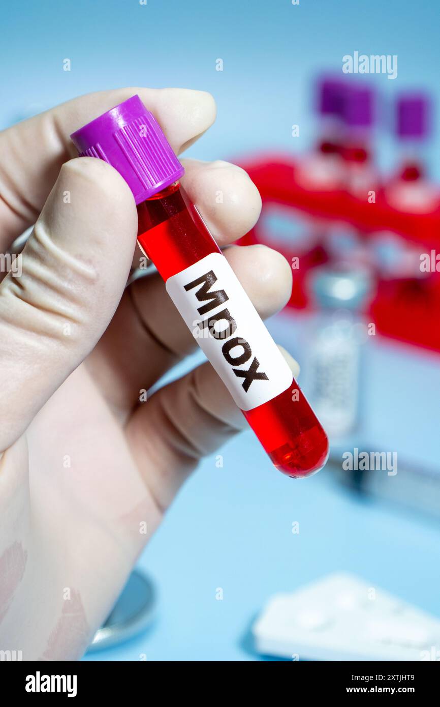 Blood collection tubes Mpox test positive results,WHO to rename ...