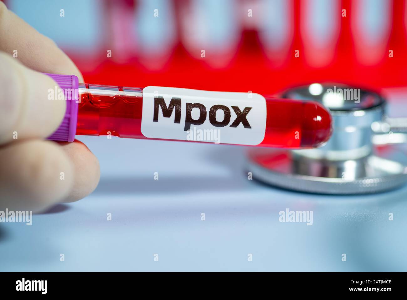 Blood collection tubes Mpox test positive results,WHO to rename ...