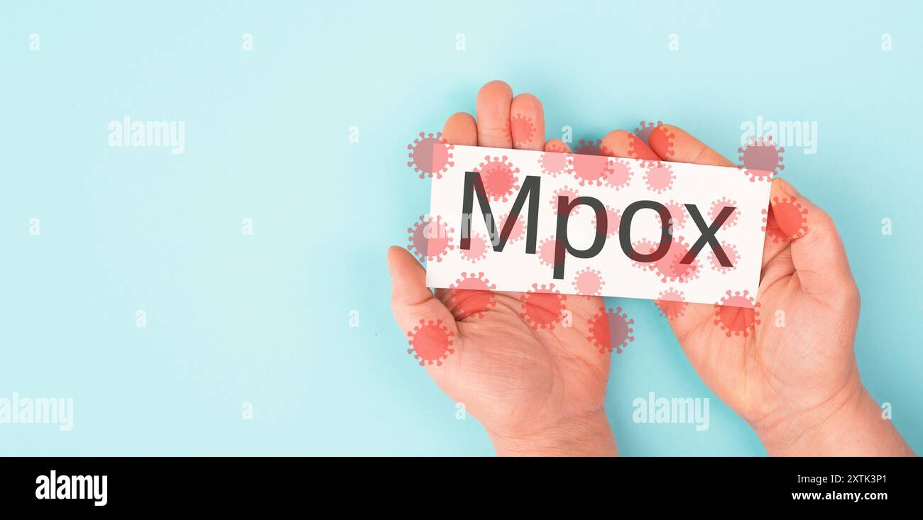 Mpox, hands with monkeypox rash, outbreak of the MPXV virus, infectious ...