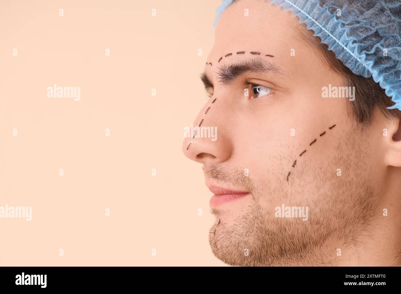 Young man with marked face on beige background, closeup. Plastic ...