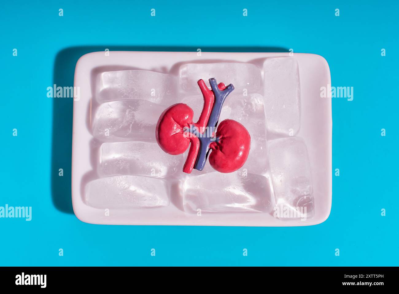 Kidney model placed on ice, illustrating importance of organ ...