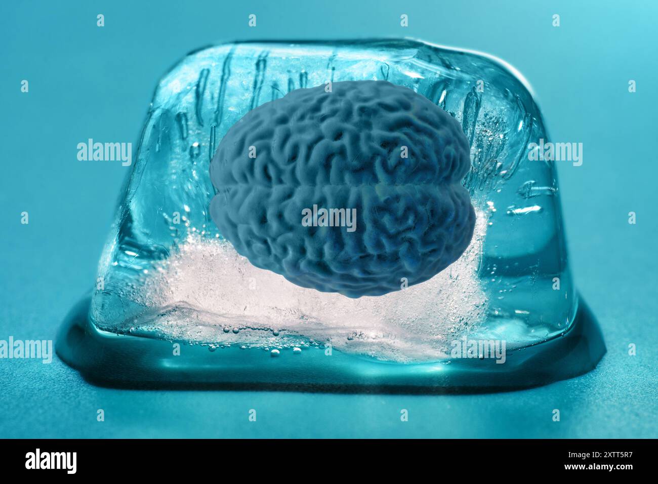 Cryogenics brain hi-res stock photography and images - Alamy