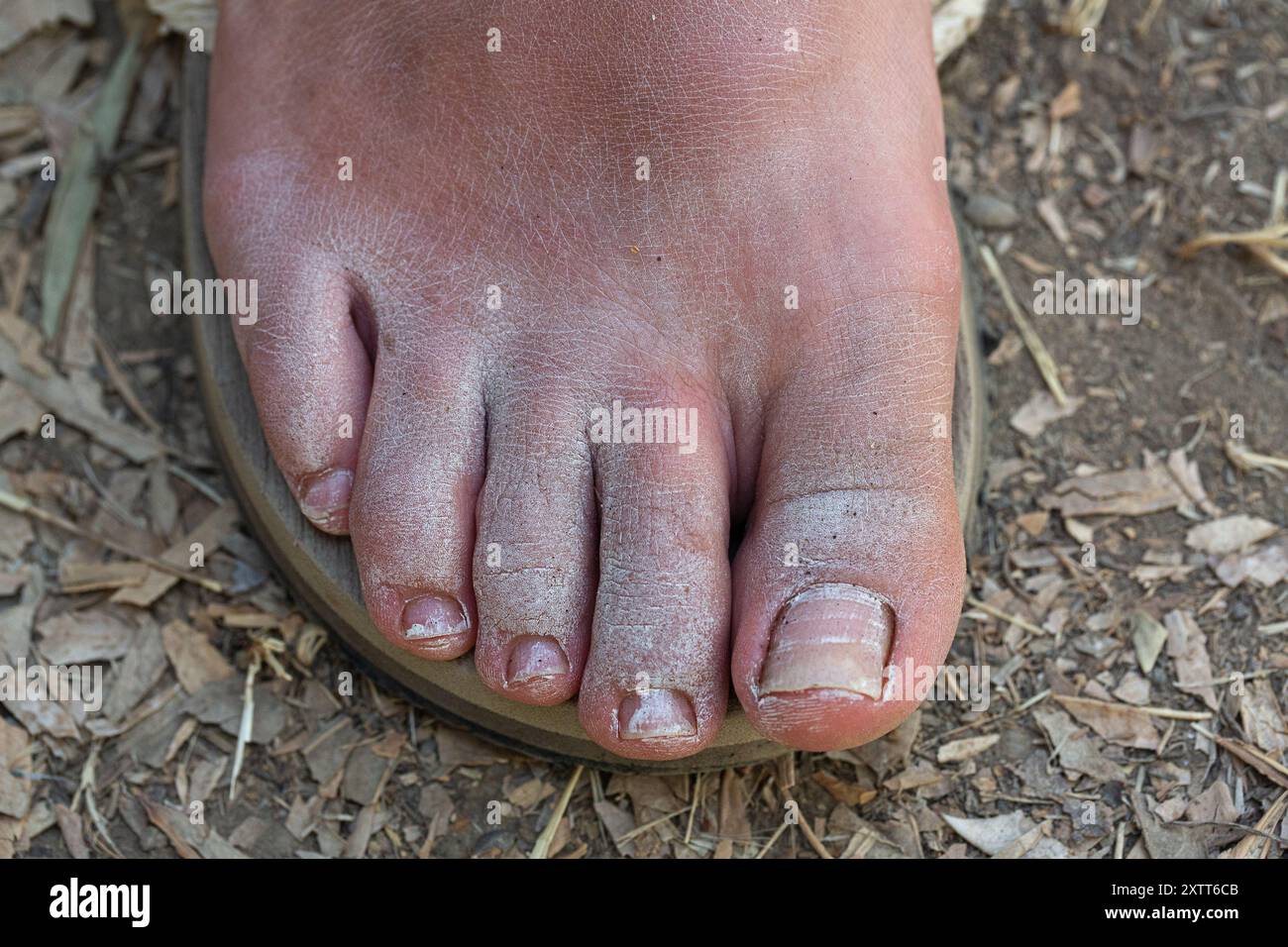 Woman's foot is caked in a layer of dry dirt after a long hike in flip ...
