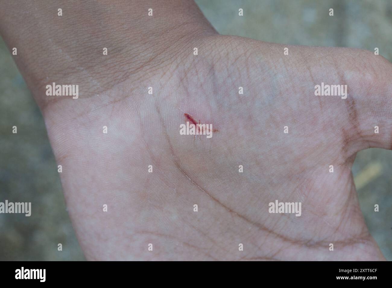 Hand cut blood bleeding hi-res stock photography and images - Alamy