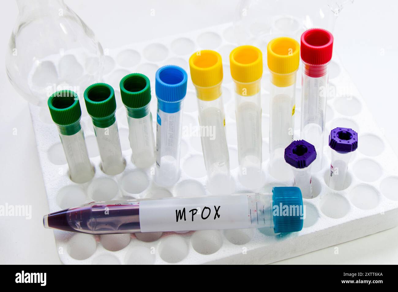 Mpox monkeypox virus, laboratory and blood test tube Stock Photo - Alamy