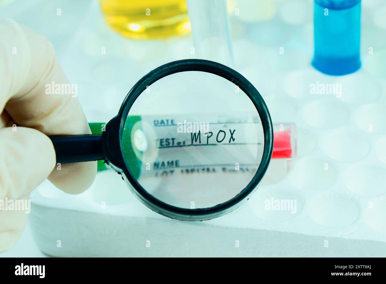 Mpox monkeypox virus, laboratory and blood test tube Stock Photo - Alamy