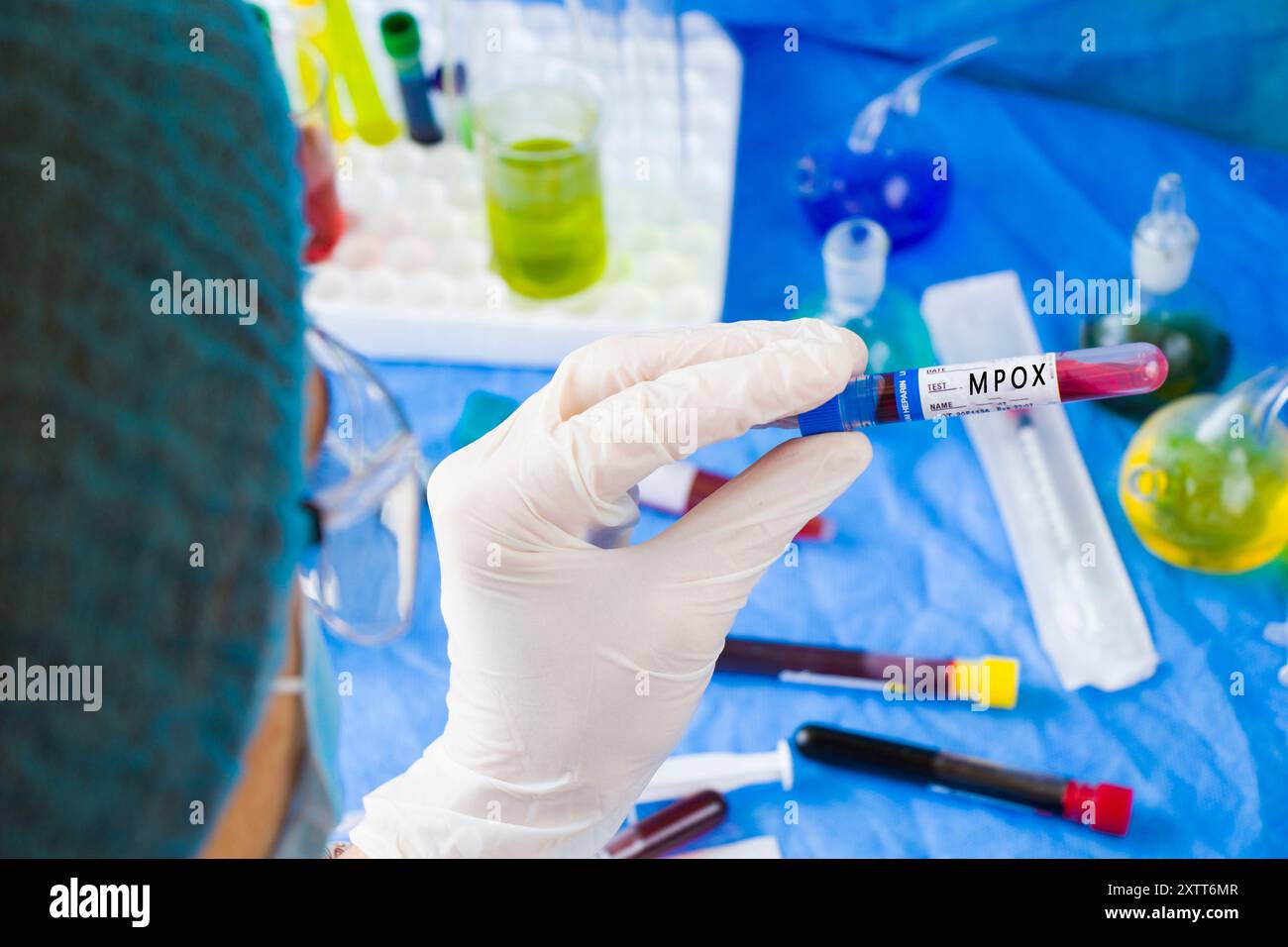 Mpox monkeypox virus, laboratory and blood test tube Stock Photo - Alamy