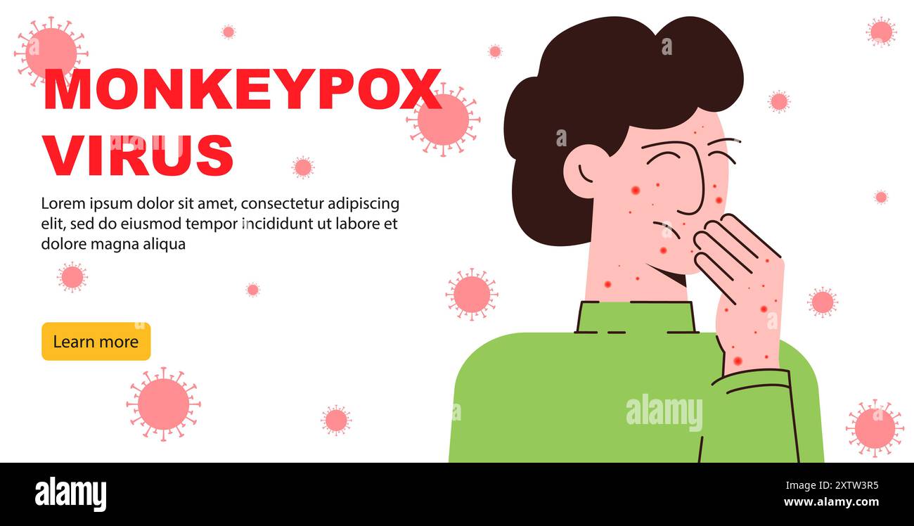 Danger of Mpox virus concept banner. Infected boy from monkey flat ...