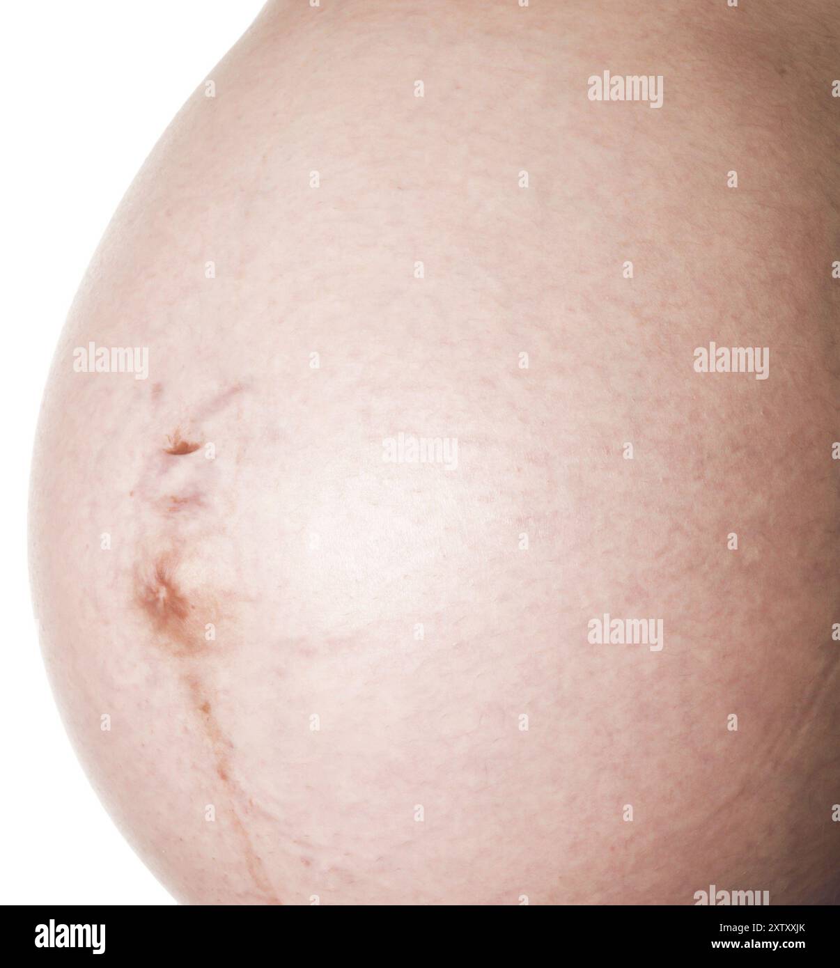 Huge pregnant belly isolated towards white background Stock Photo - Alamy