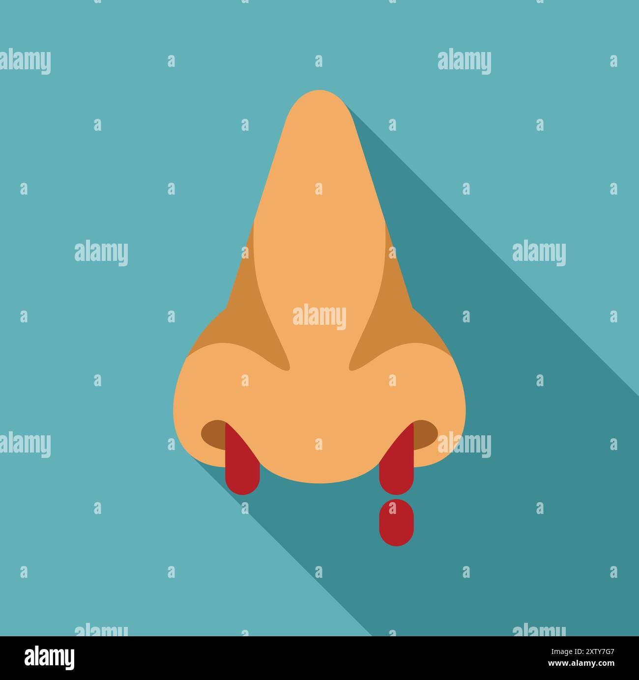 Human nose bleeding showing epistaxis symptom in flat style Stock ...