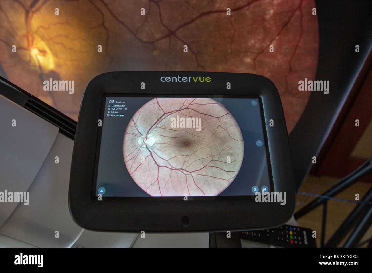 Kyiv, Ukraine - April 18, 2024: CenterVue wide angle retinal camera for ...