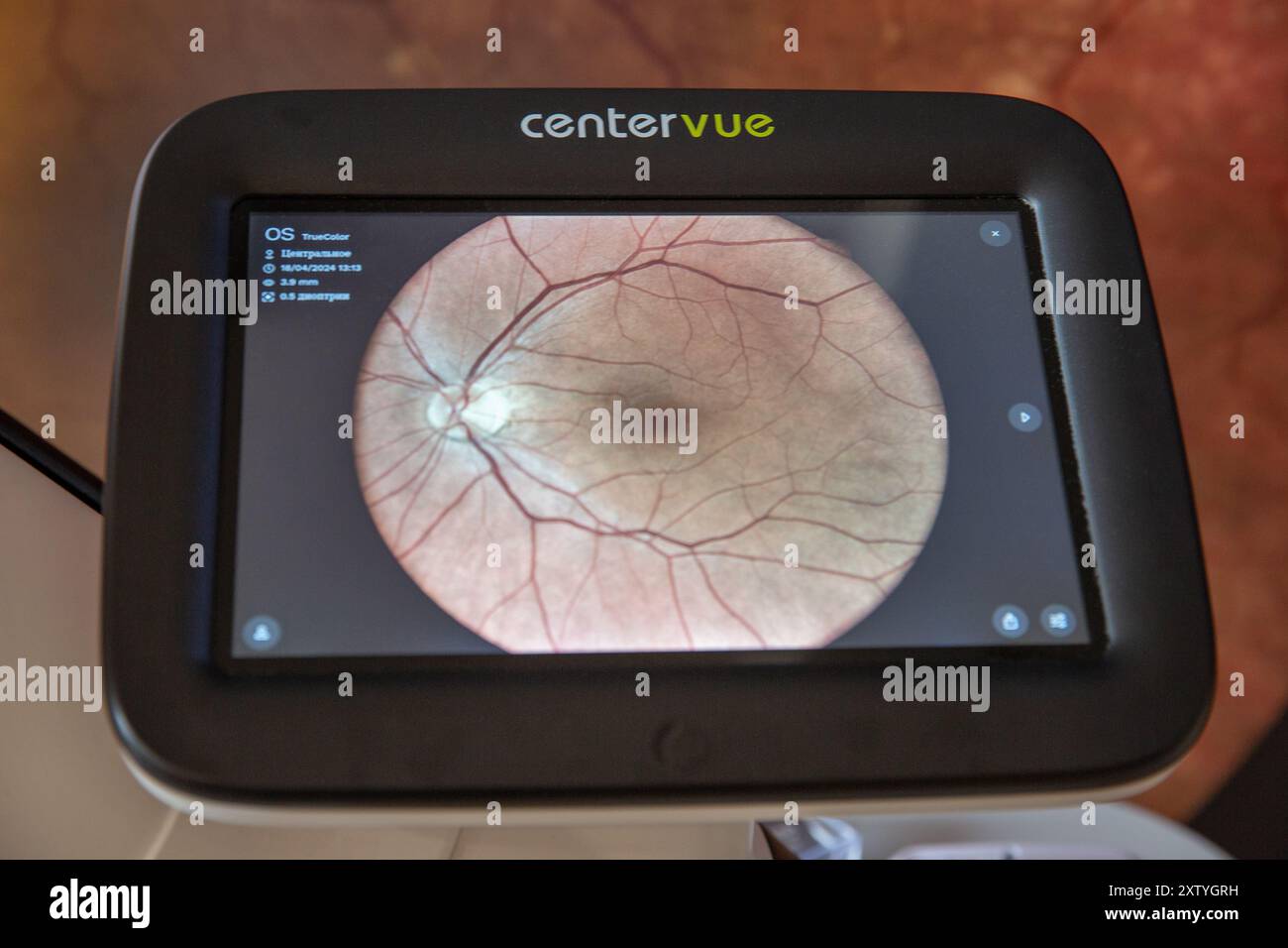 Kyiv, Ukraine - April 18, 2024: CenterVue wide angle retinal camera for ...