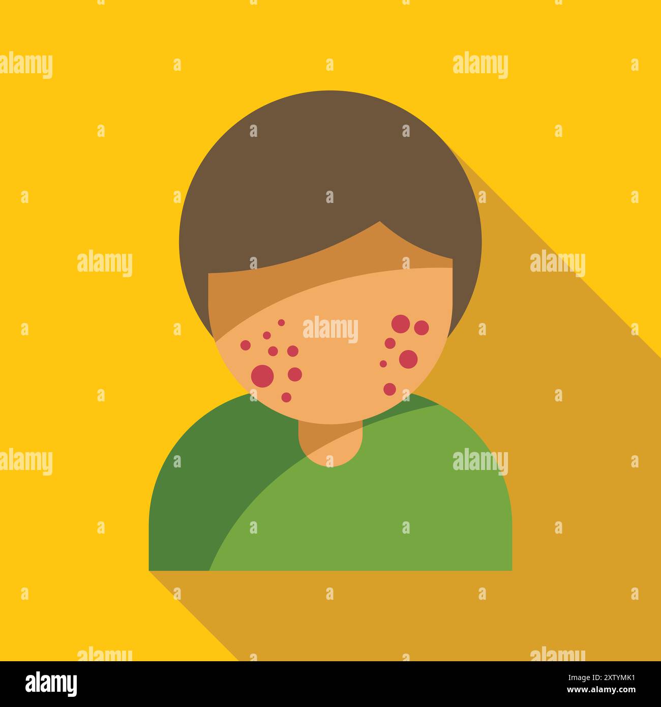 Flat design icon of a young person with a chickenpox skin rash Stock ...