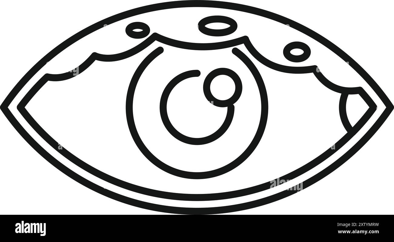 This simple vector illustration of a bloodshot eye is perfect for ...