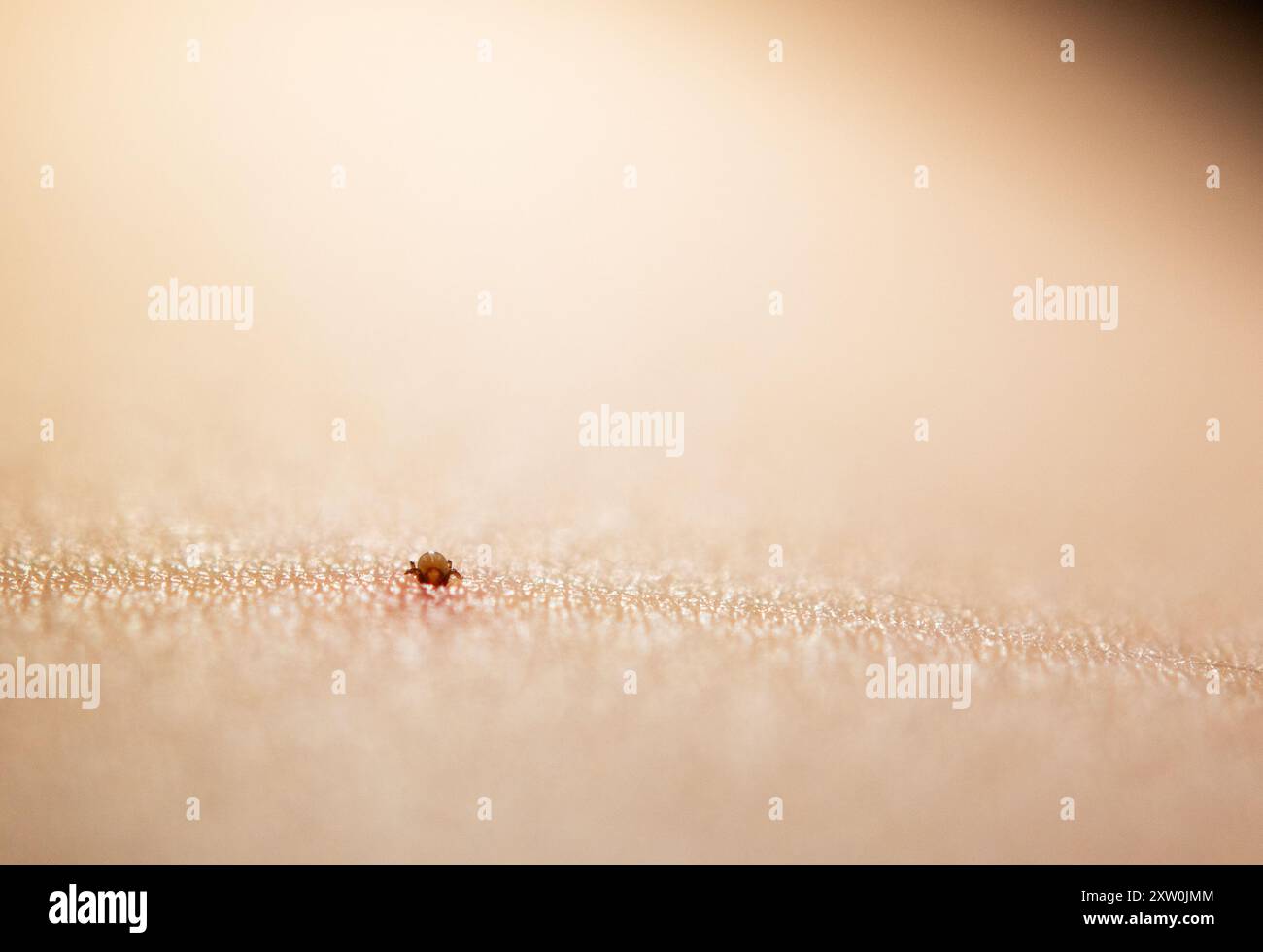 A detailed close-up view of a tick firmly embedded in human skin ...