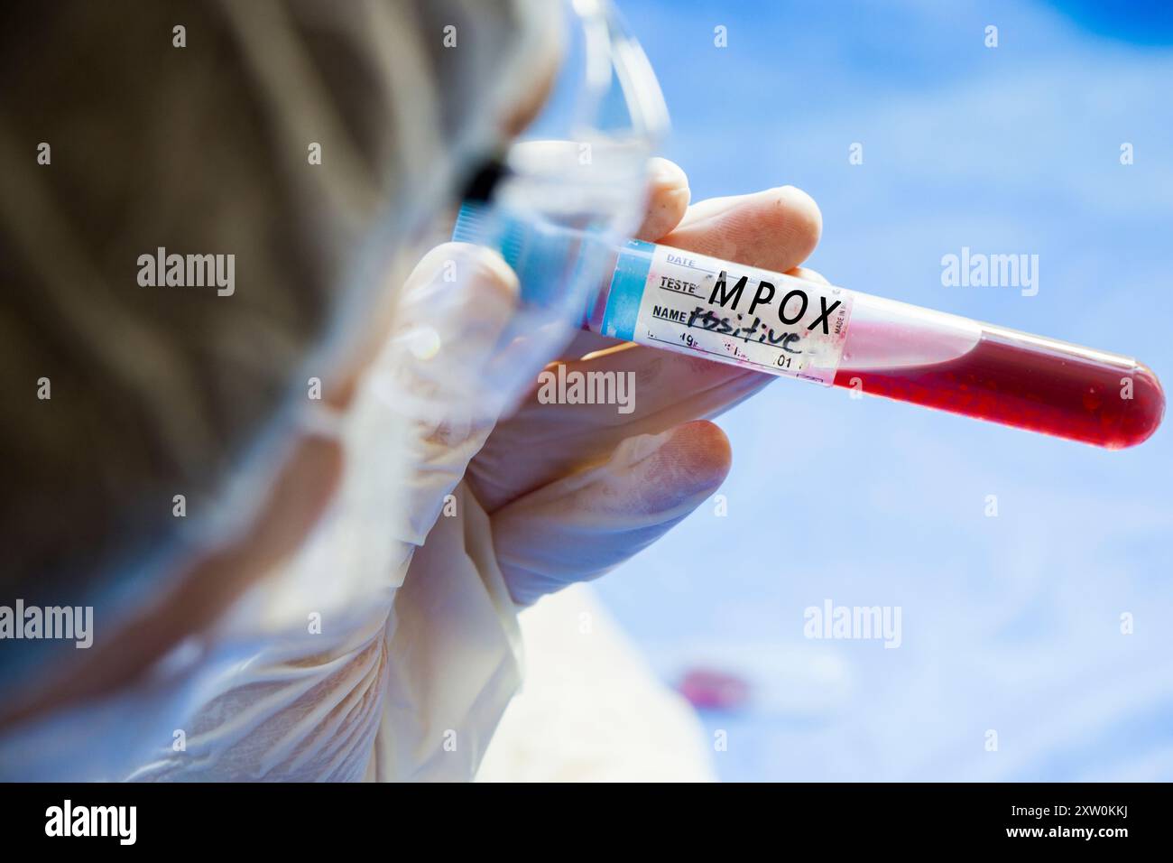 Mpox blood test empty tubes samples on the white background, studio ...