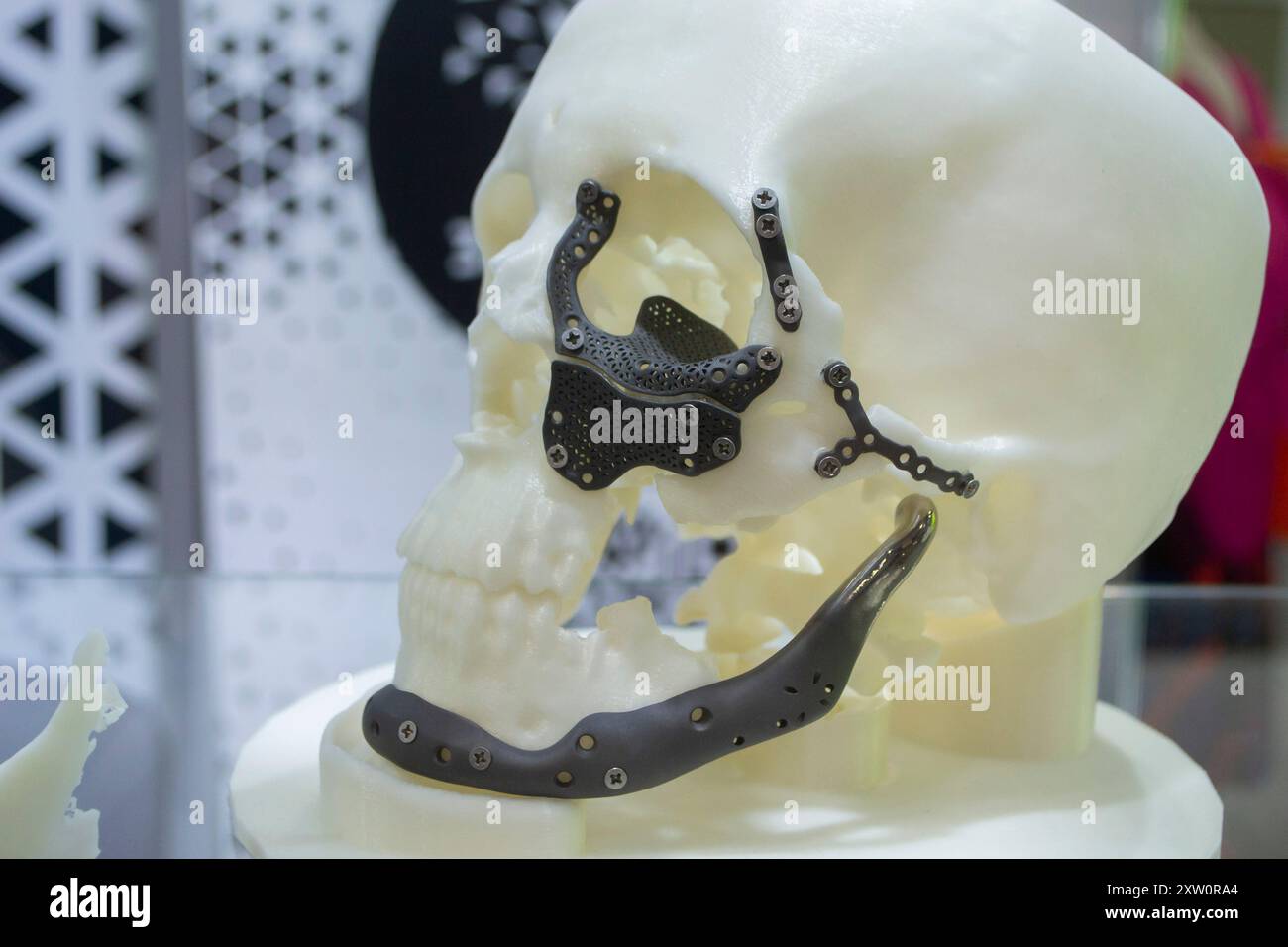 Prototype of human skull from white plastic with titanium implants in ...