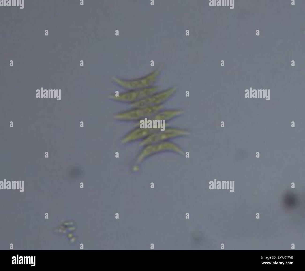 (Tetradesmus dimorphus) Plantae Stock Photo - Alamy